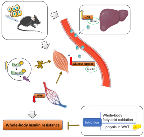 Insulin action related to muscle hypertrophy and cancer v/ Xiuqing Han ...